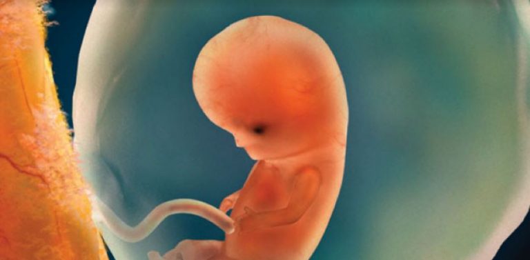 Future of Regenerative Medicine with Kyle Cetrulo of AuxoCell ...