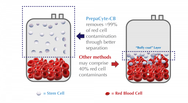 PrepaCyte-CB Processing Takes Leads in Engraftment Time
