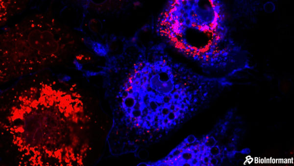 Multipotent Stem Cell Benefits and Their Emerging Uses in Medicine