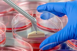 Stem Cell Infusion: What to Expect | BioInformant