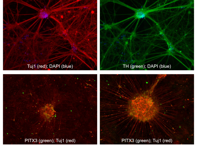 Generation of iPSC-derived Parkinson’s Disease Neurons
