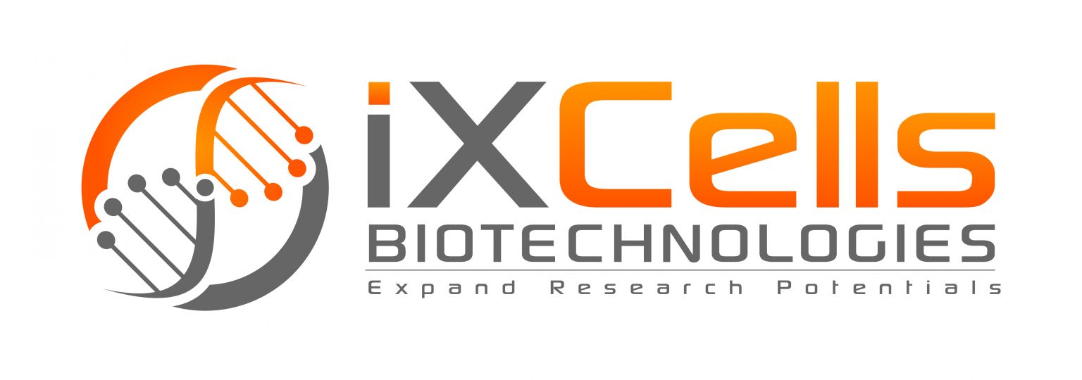 Interview with Dr. Nianwei Lin, Co-Founder and President of iXCells ...