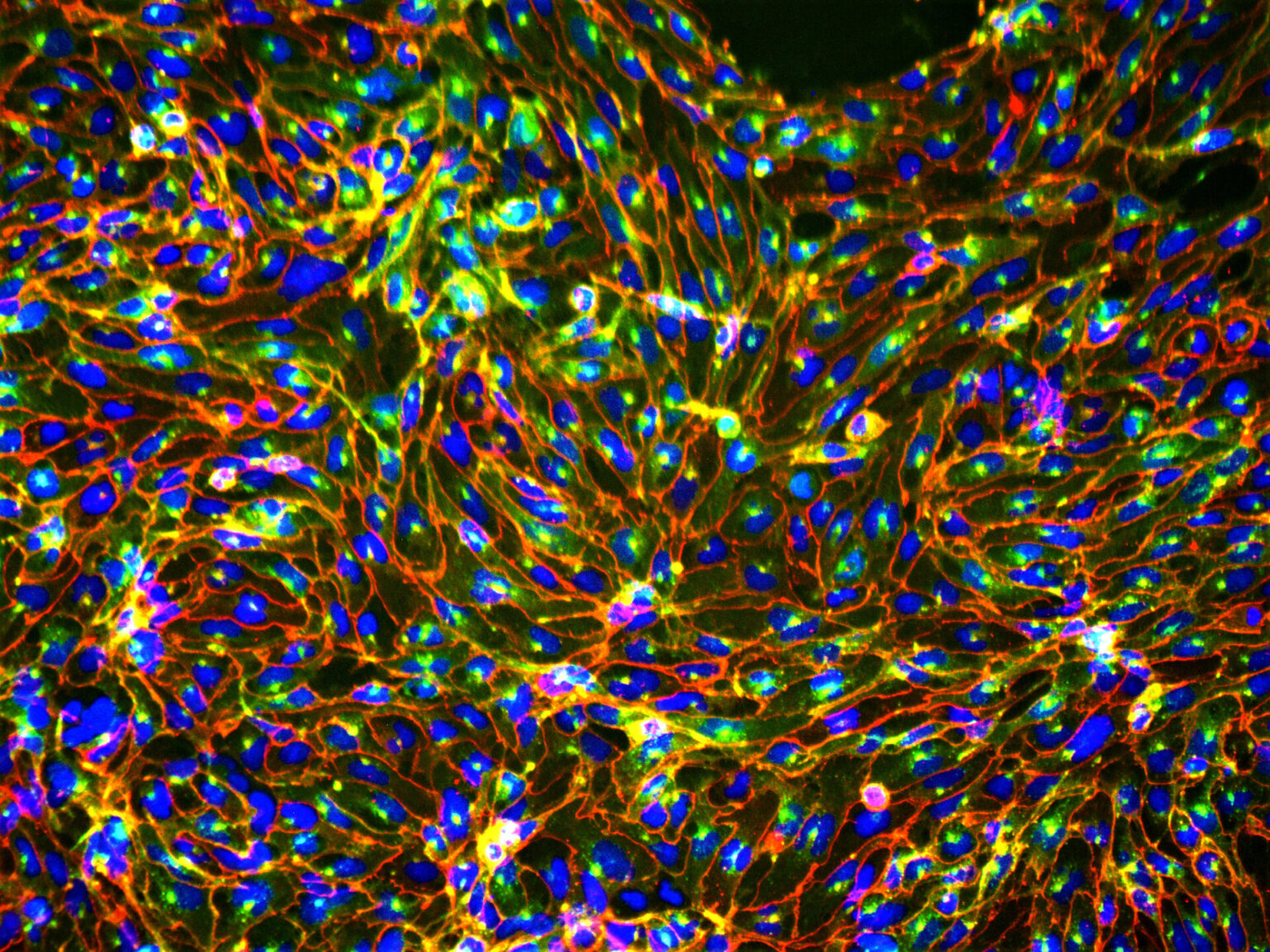 When a Network Matters! Functional iPSC-derived Endothelial Cells ...