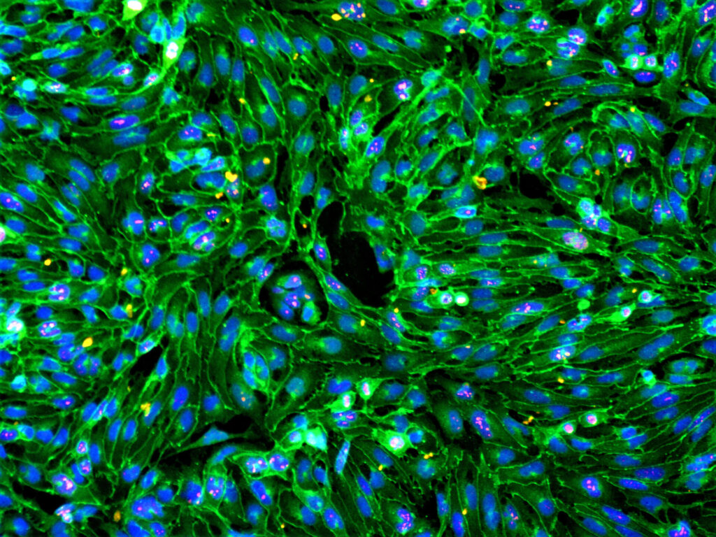 When a Network Matters! Functional iPSC-derived Endothelial Cells ...