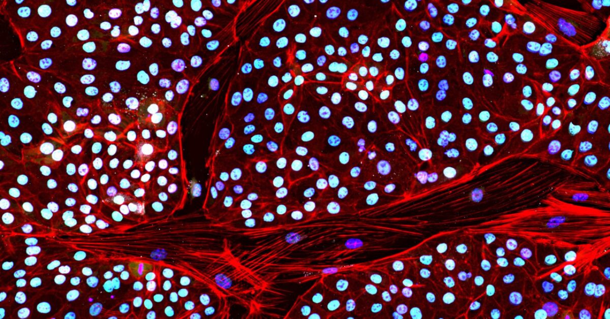 Revolutionary Elephant iPSC Milestone Reached in Colossal’s Woolly ...