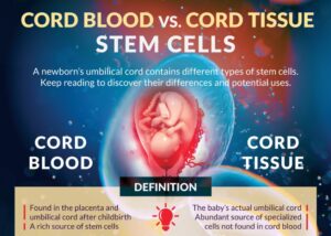 Cord Blood vs. Cord Tissue Stem Cells: What are the Differences?
